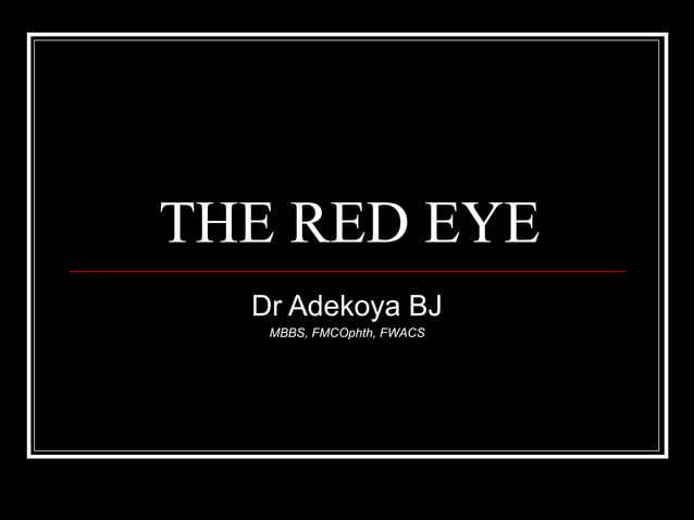The red eye | PPT