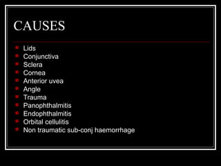 The red eye | PPT | Eye and Vision Conditions | Diseases and Conditions