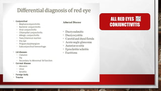 The RED EYE | PPTX
