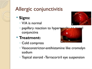 The Red Eye conjuctival diseases of the eyepptx | PPT