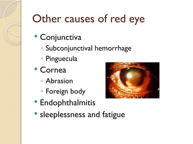 The Red Eye conjuctival diseases of the eyepptx | PPT