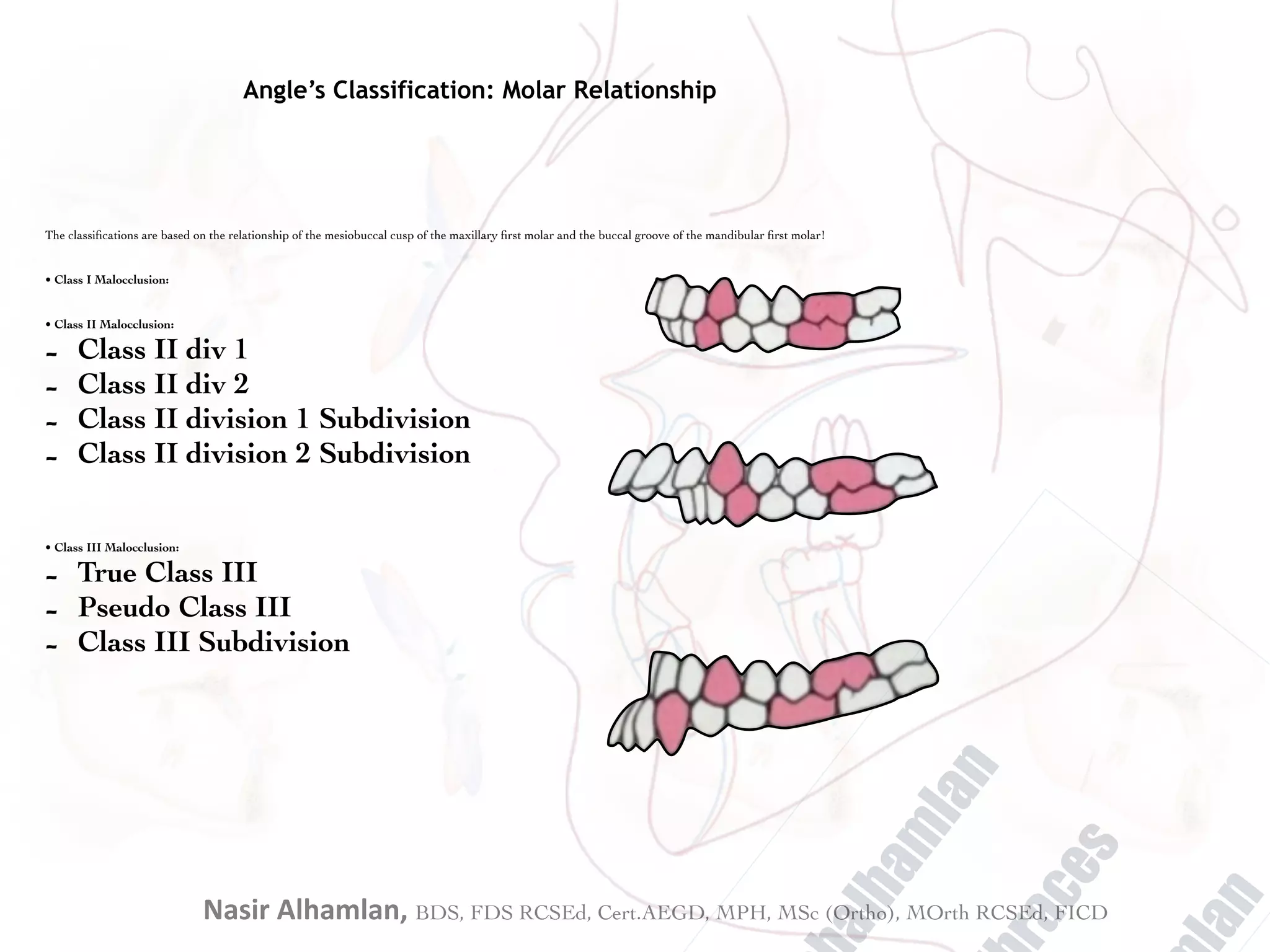 The relation between skeletal pattern and malocclusion (Incisor and ...
