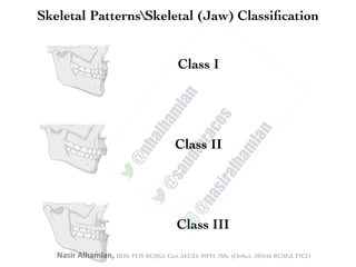 The relation between skeletal pattern and malocclusion (Incisor and ...