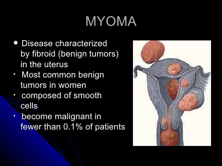 REPRODUCTIVE DISORDERS OF RICHARDS, FILAMER