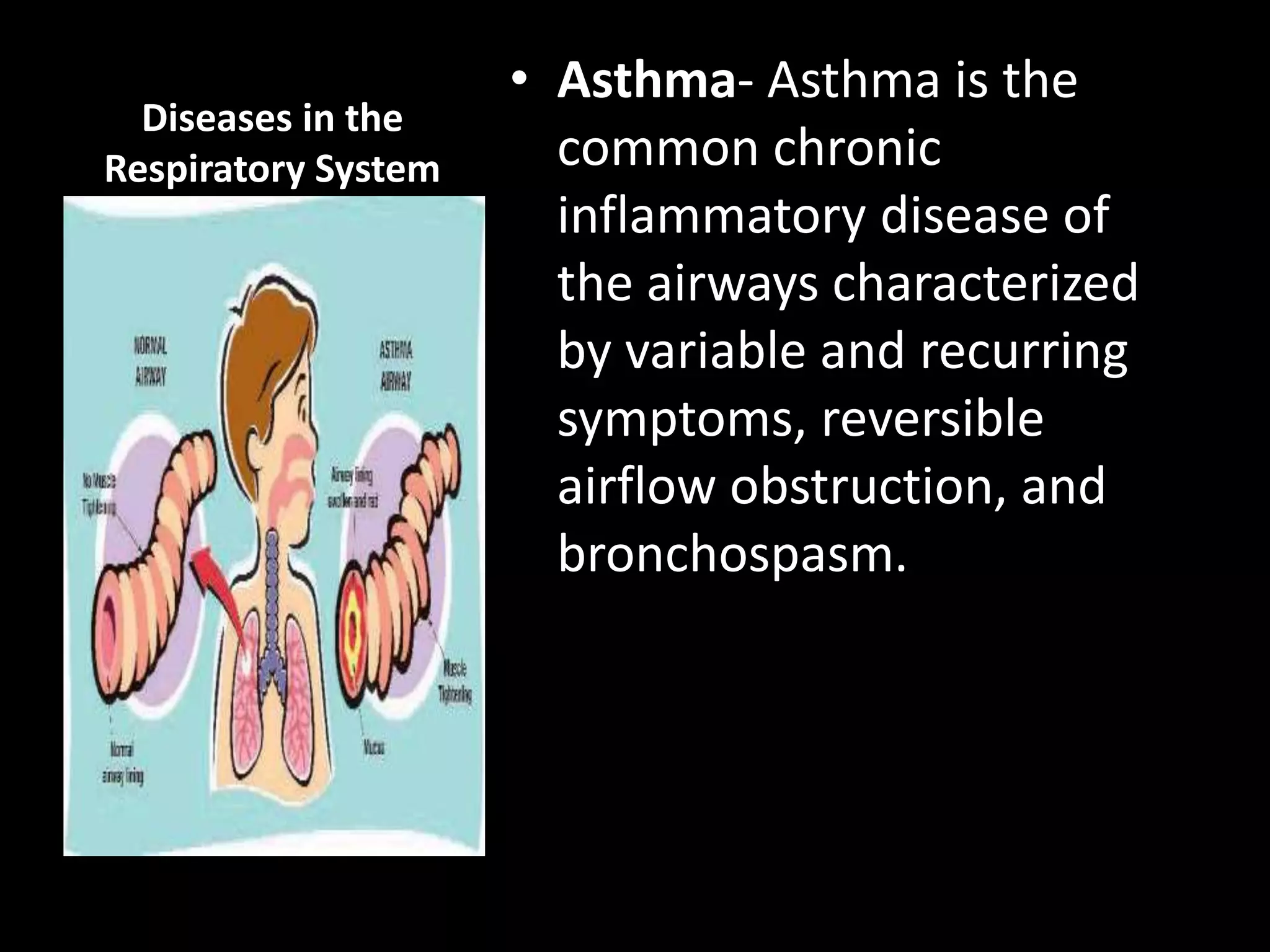 The respiratory system | PPTX | Lung and Respiratory Health | Diseases ...