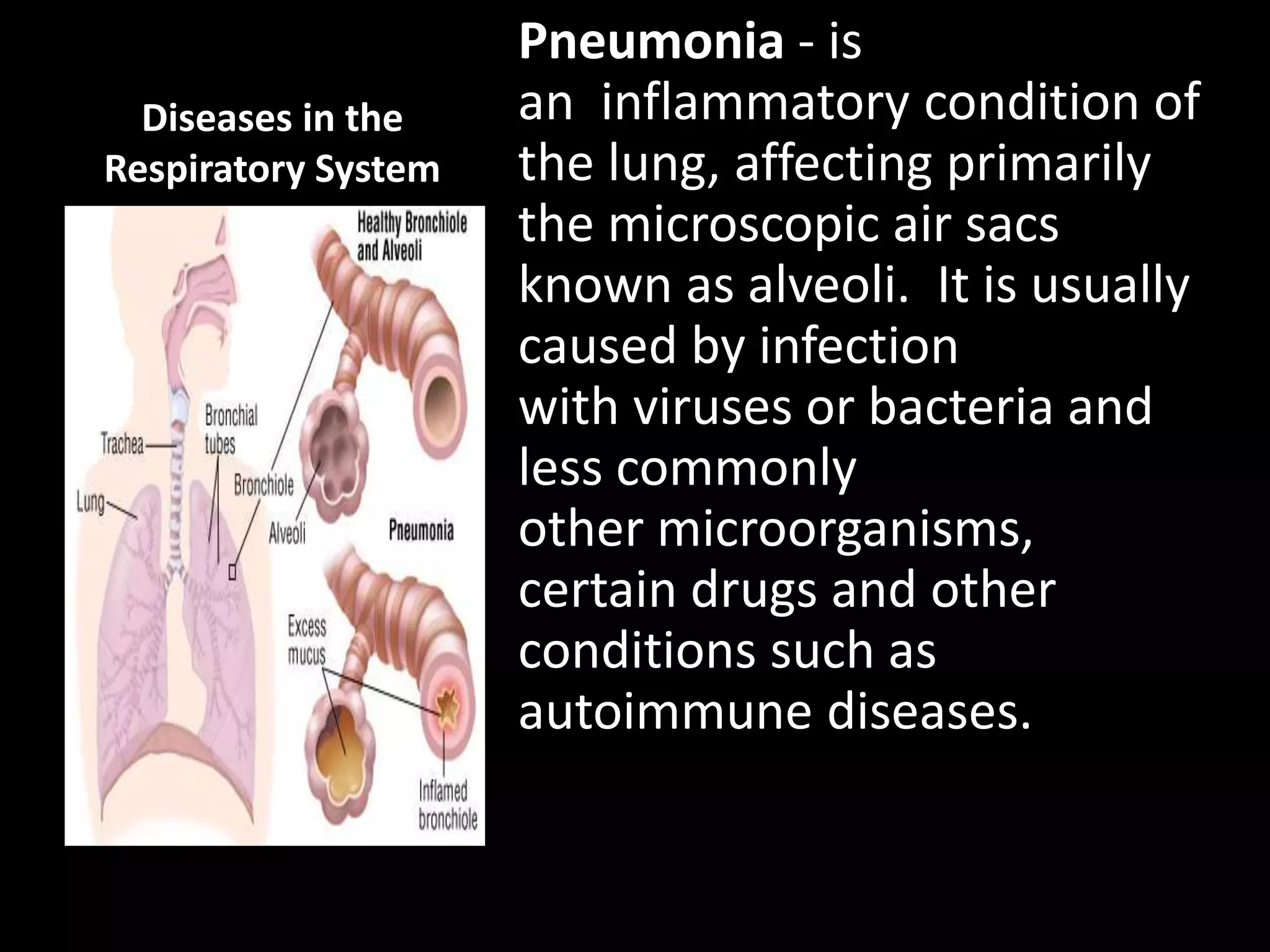 The respiratory system | PPTX | Lung and Respiratory Health | Diseases ...