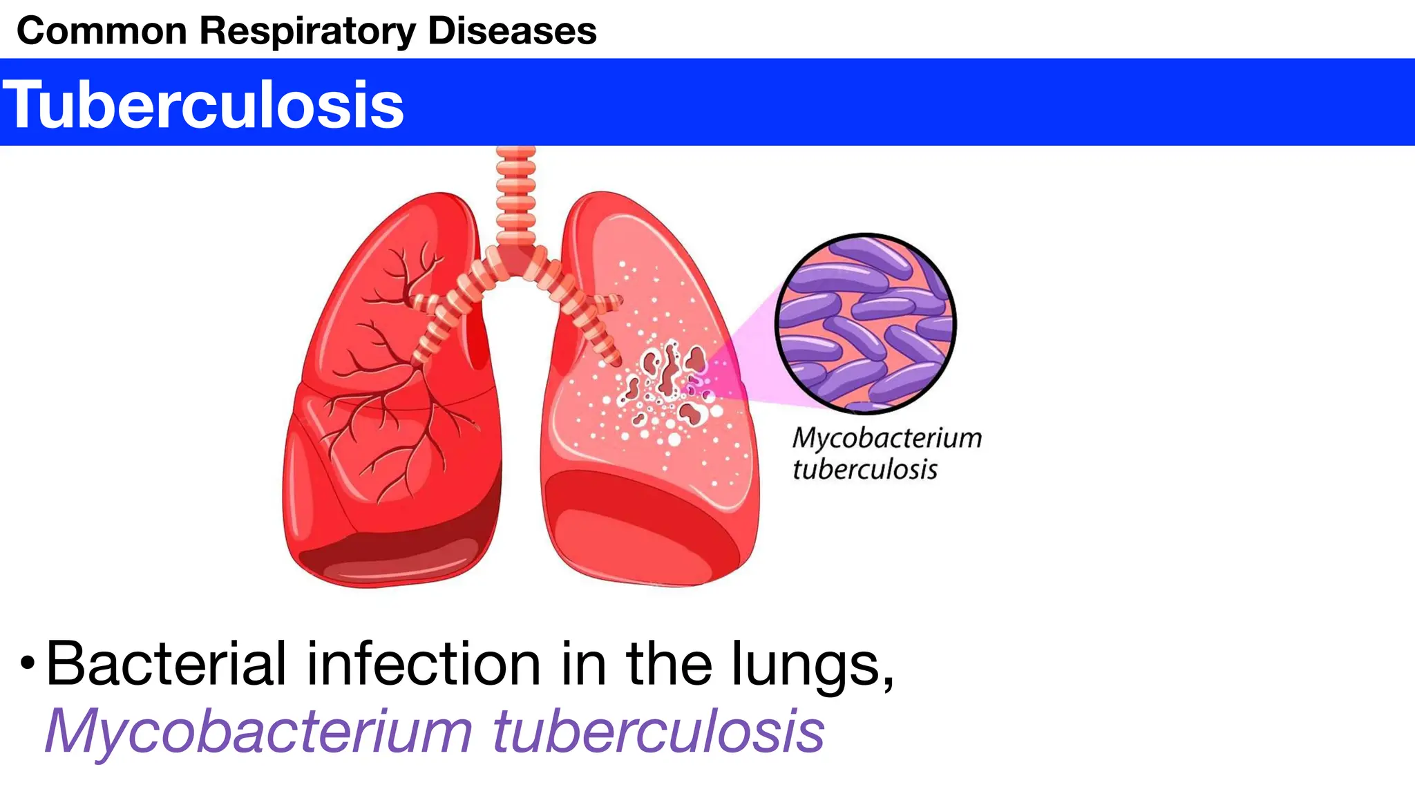 Understanding the Human Respiratory System | PDF