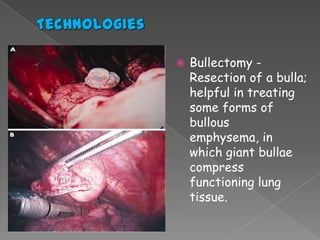 The respiratory system report xxxx | PPTX