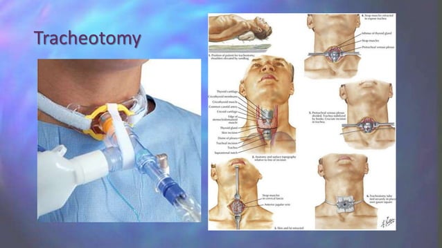 The Respiratory System | PPTX