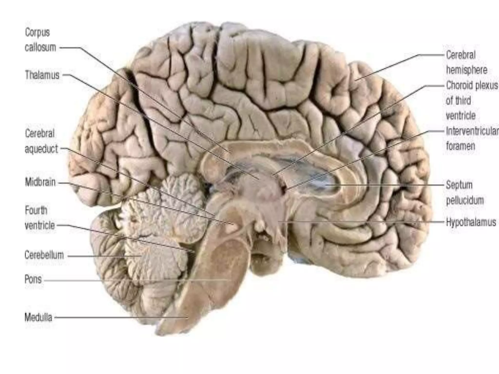 The Rhombencephalon or Hind brain.ppt