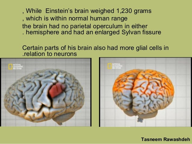 The Rriddle Of Einstein's Brain