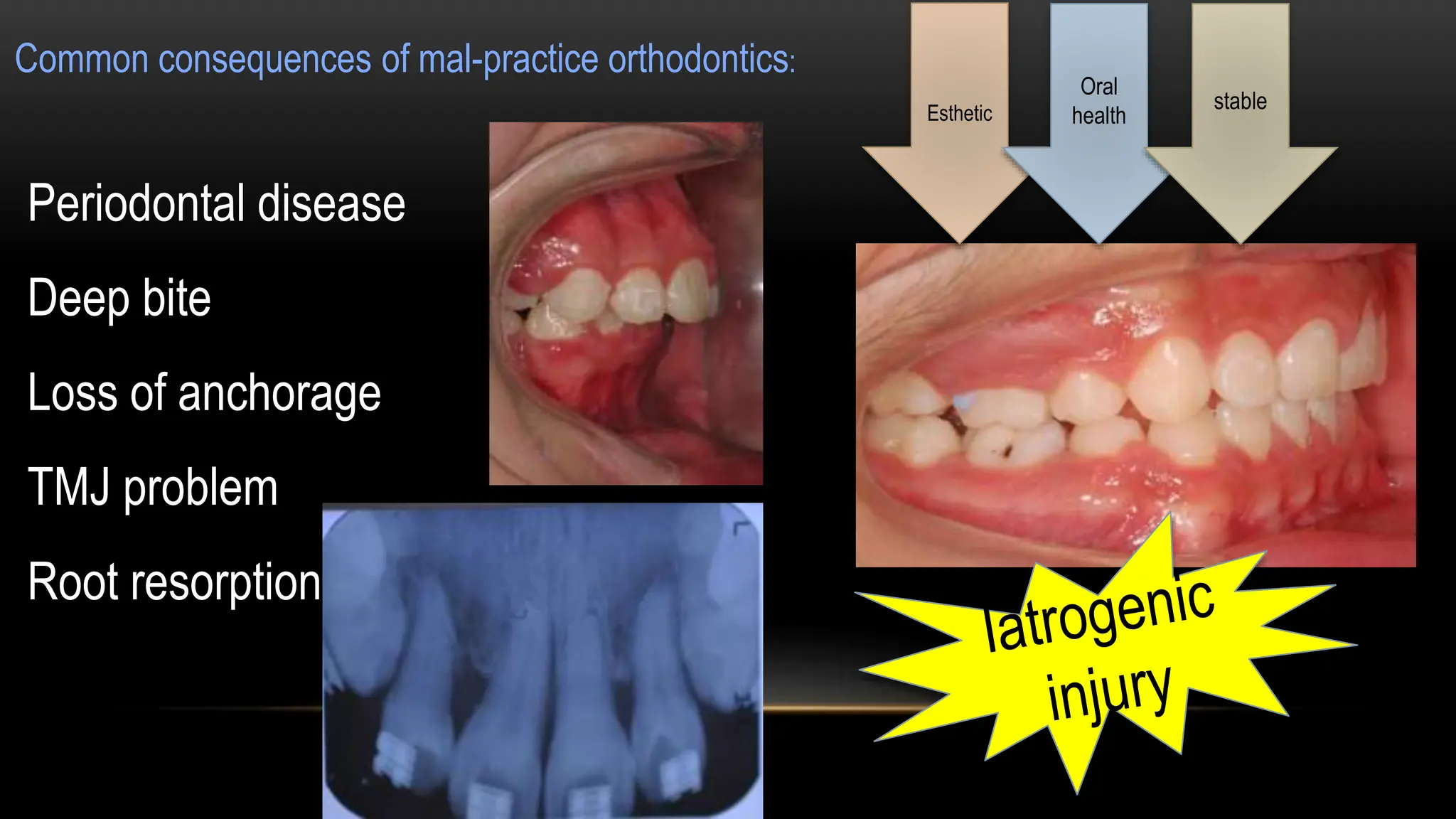 The risk of mal-practice orthodontic treatment.pptx