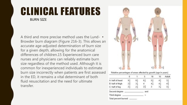 Thermal burns | PPT