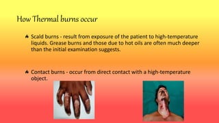 Thermal burns with anatomy of skin. | PPTX