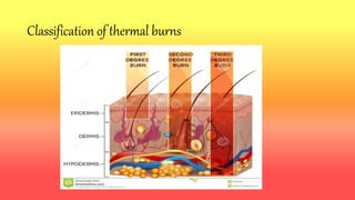 Thermal burns with anatomy of skin. | PPTX