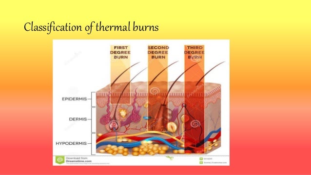 Thermal burns with anatomy of skin.