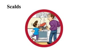 Thermal injuries | PPTX