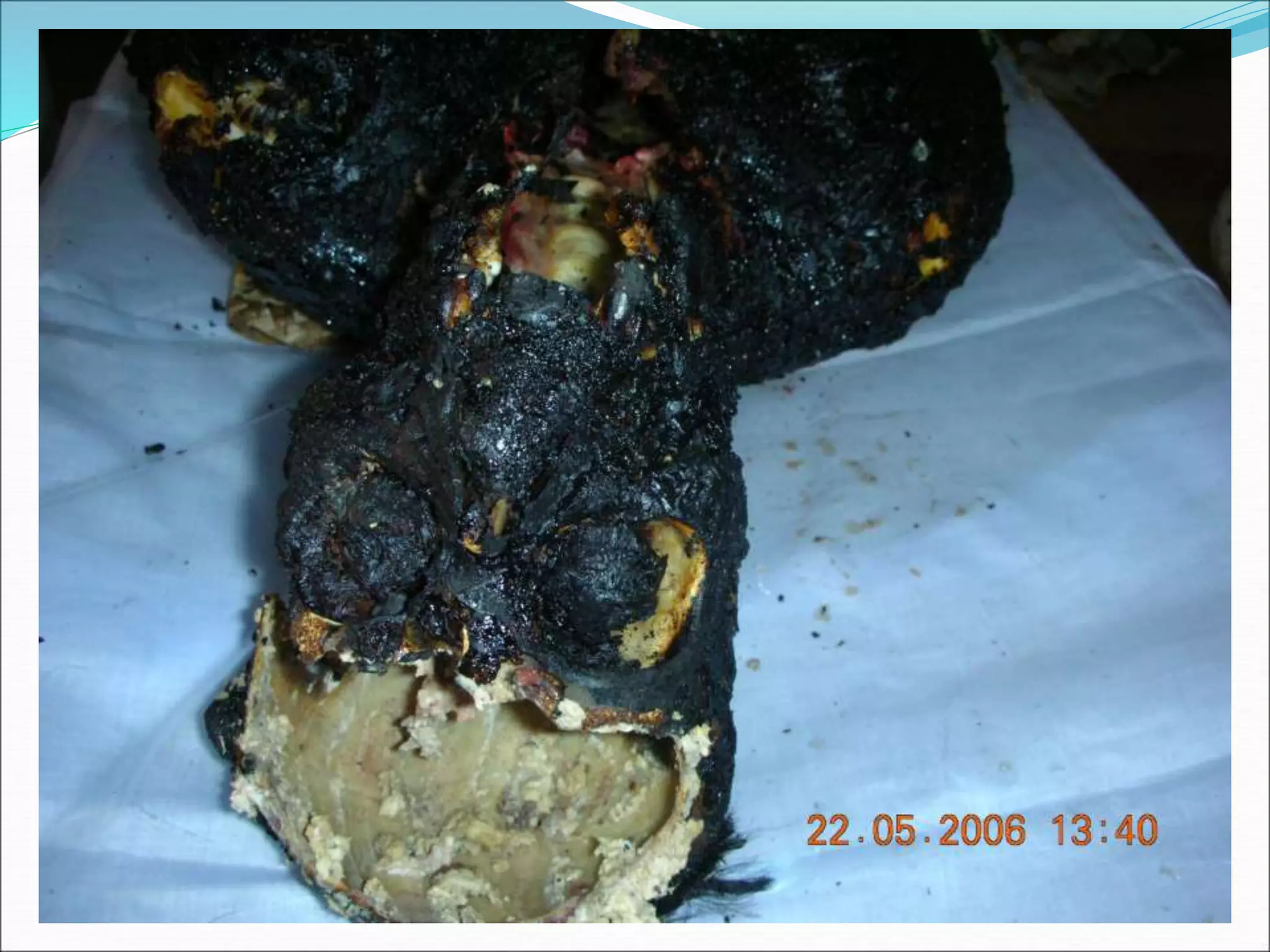 thermal injuries.pptx