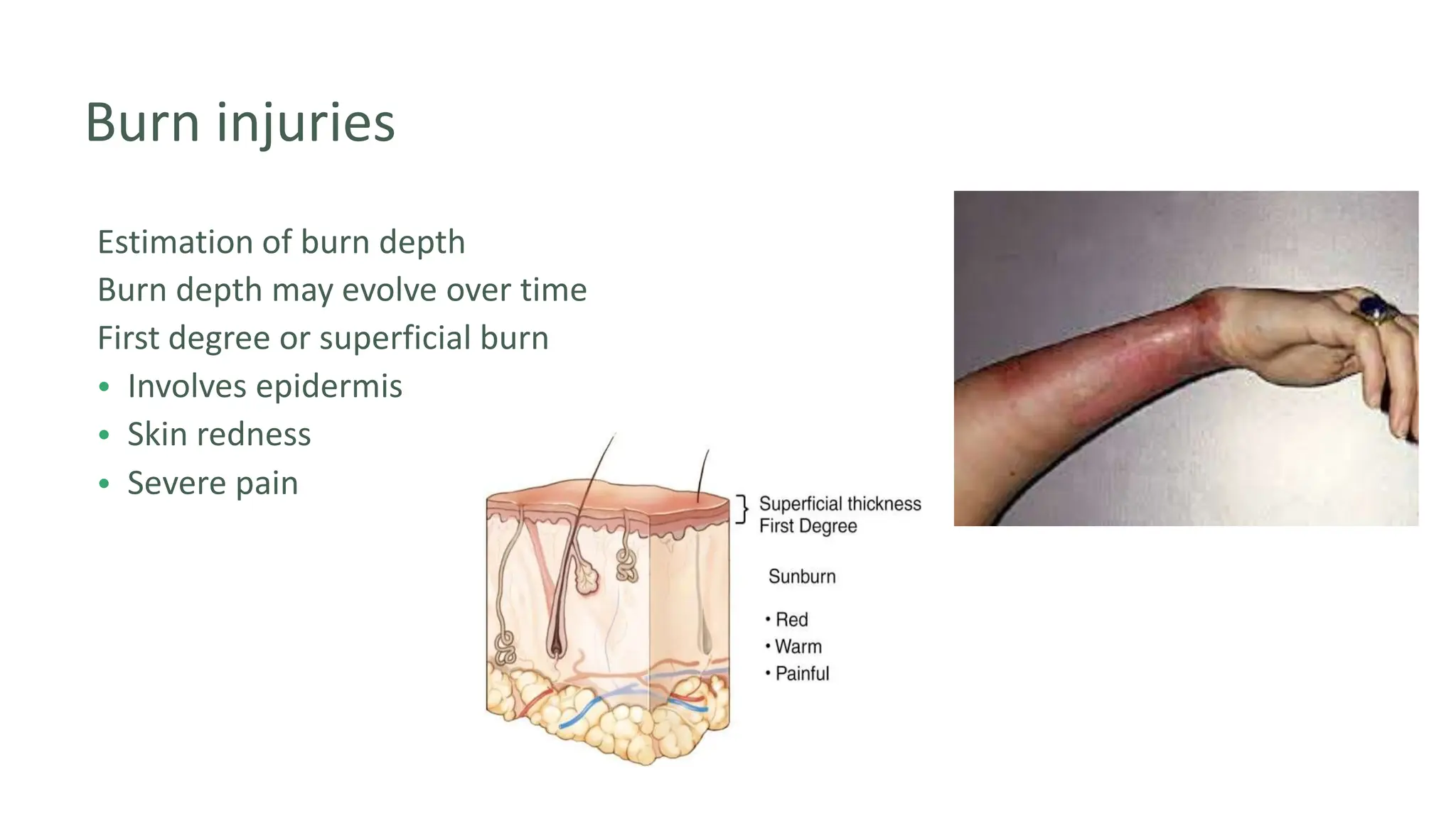 Thermal injuries or thermal burn...pptx