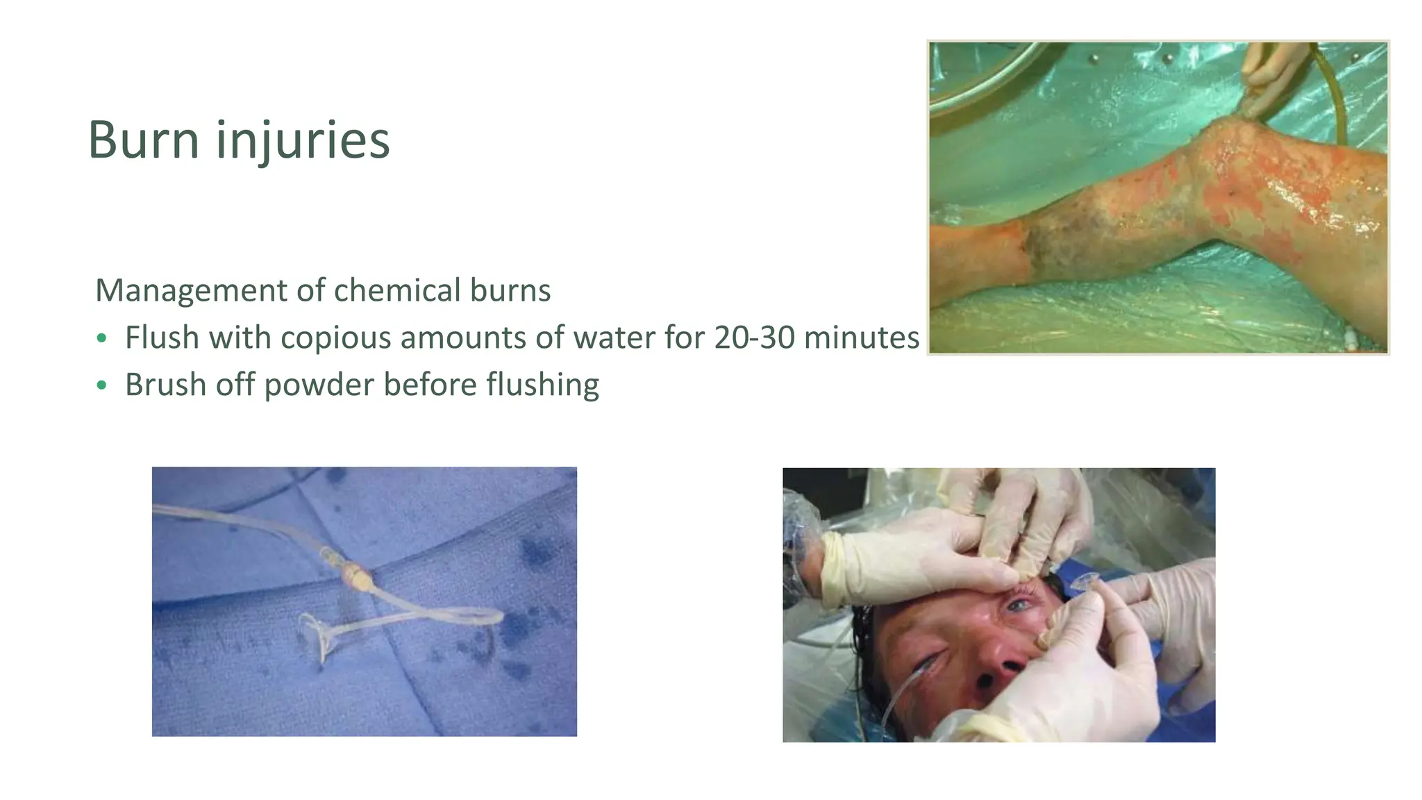 Thermal injuries or thermal burn...pptx