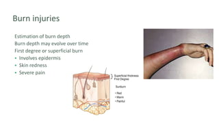 Thermal injuries or thermal burn...pptx