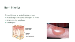 Thermal injuries or thermal burn...pptx