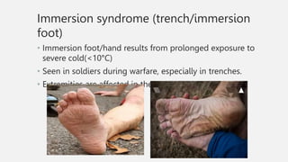 Thermal injuries-72.pptx