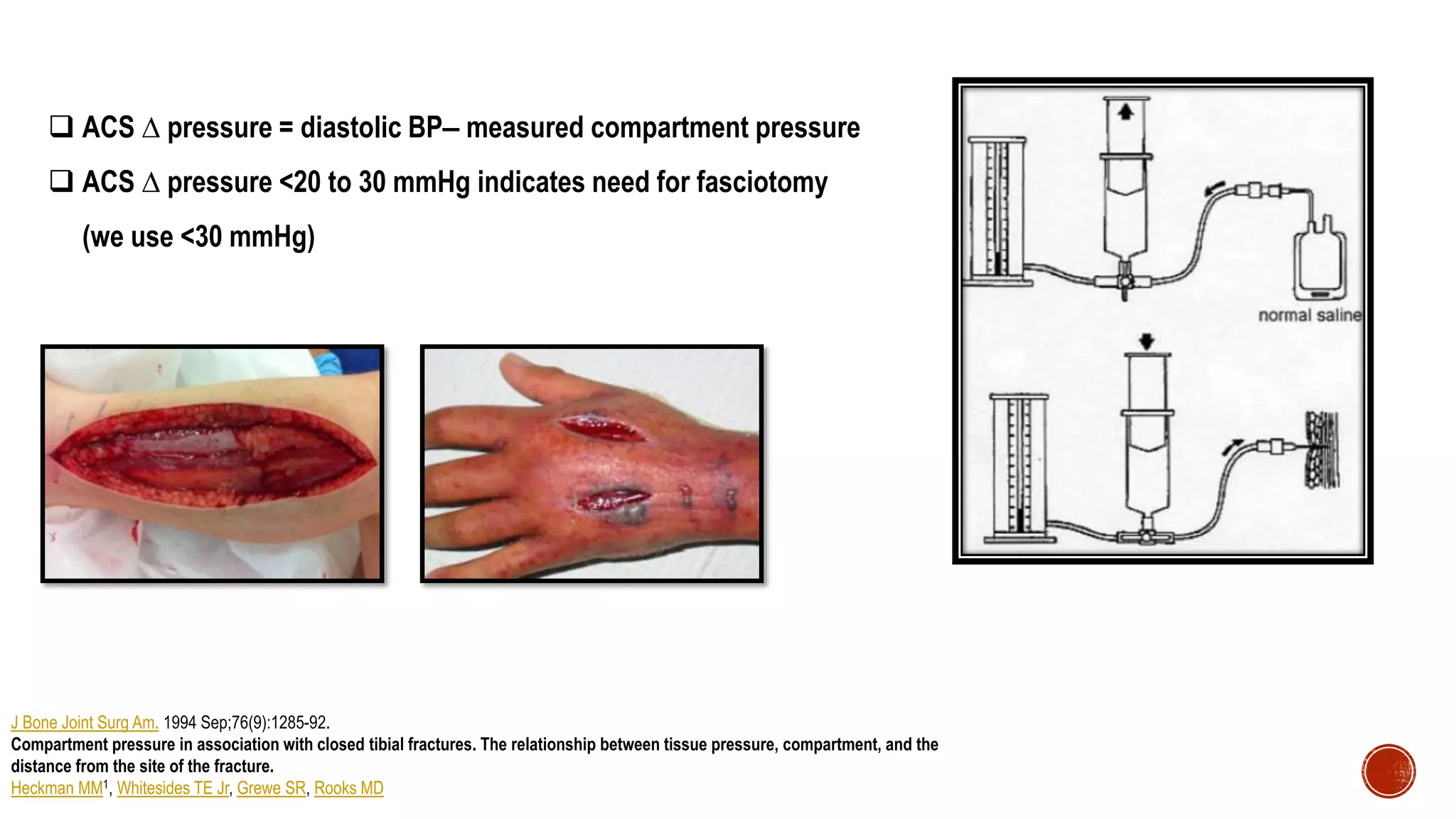 Thermal injuries -plastic surgery | PPTX
