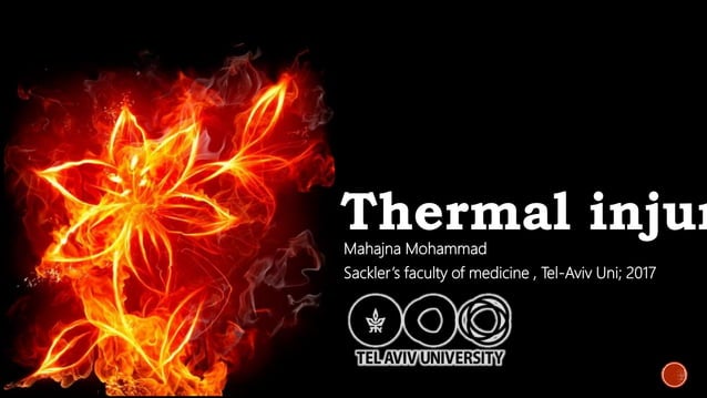 Thermal injuries -plastic surgery | PPT