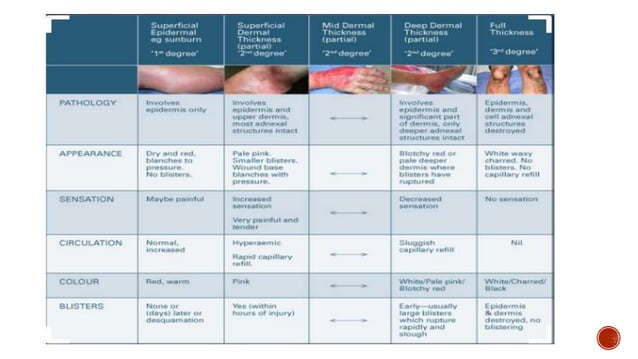 Thermal injuries -plastic surgery | PPT