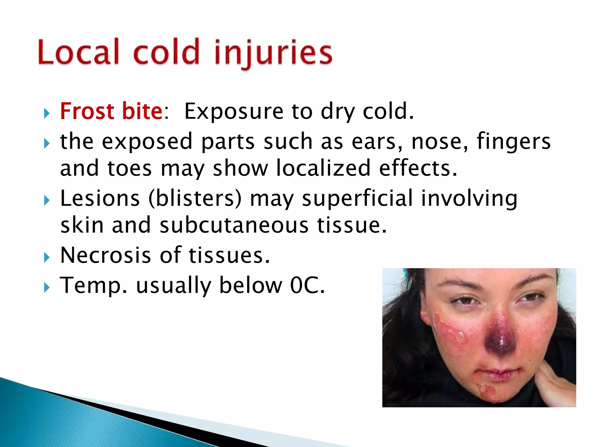 Thermal injury | PPTX