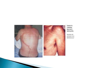 Thermal injury | PPTX