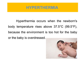 Thermal protection of NEWBORN CHILDRENpptx | PPTX