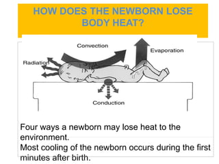Thermal protection of NEWBORN CHILDRENpptx | PPTX