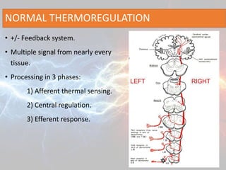 Perioperative Thermoregulation | PPTX