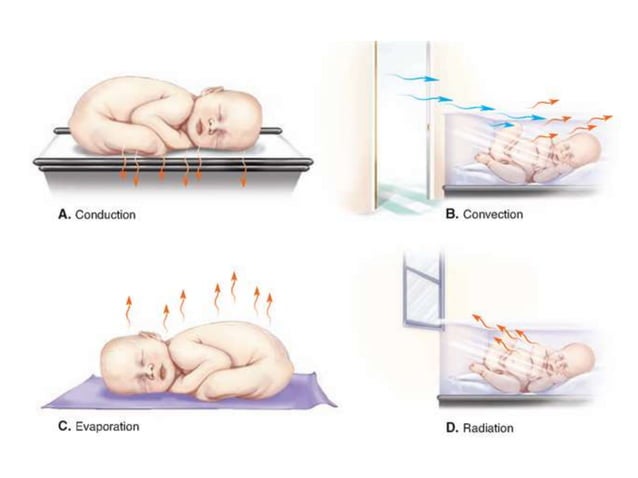 THERMOREGULATION IN NEONATES.pptx