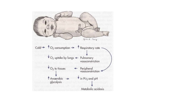 Thermoregulation in newborn | PPTX | Parenting Babies and Toddlers ...