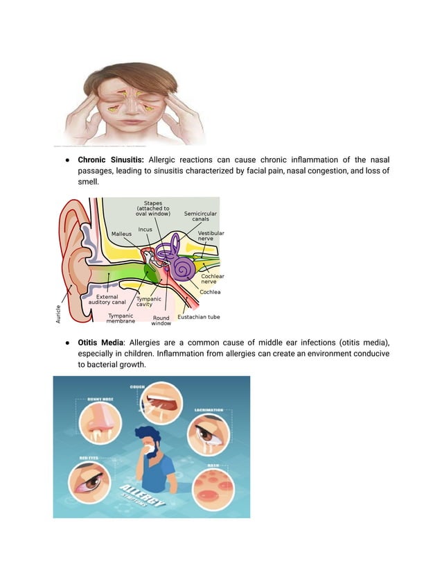 The Role of Allergies in ENT Disorders_ Understanding Causes and ...