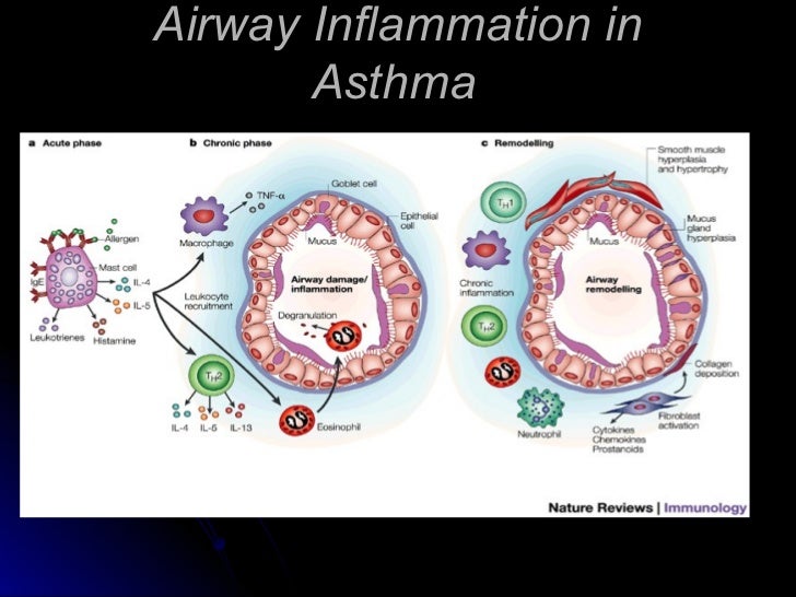 The role of anti-IgE therapy in asthma management