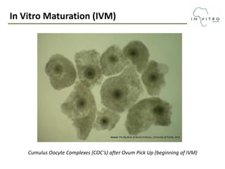 The role of assisted reproductive techniques (art’s) in building a ...