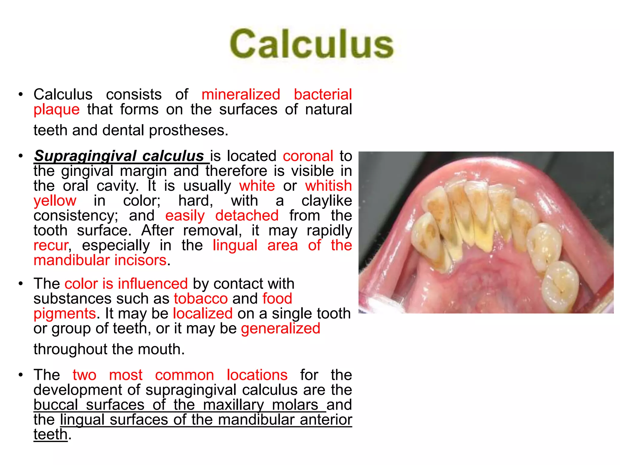 The_Role_of_Dental_Calculus_and_other_Pre_disposing_Factors_المحاضرة.pptx