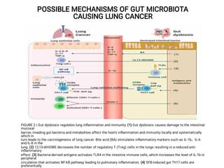Gut Microbiota in Lung Cancer_Indrawaty_Gizi.pdf