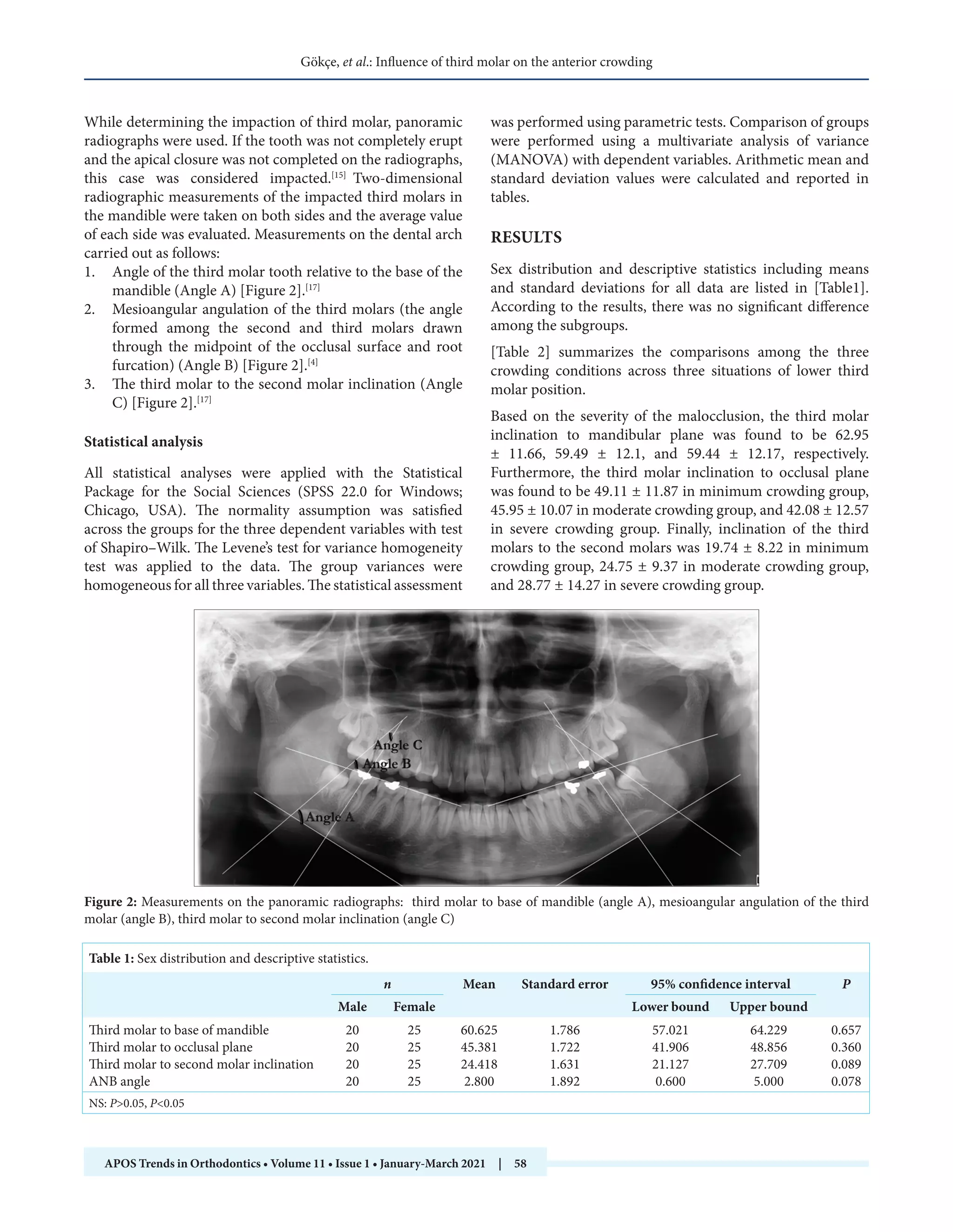 The role of impacted third molar angulation on the anterior crowding ...