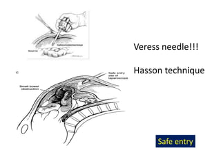 The role of laparoscopy in acute care surgery | PPT