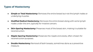 The Role of Mastectomy in Breast Cancer Treatment.pdf | Cancer ...