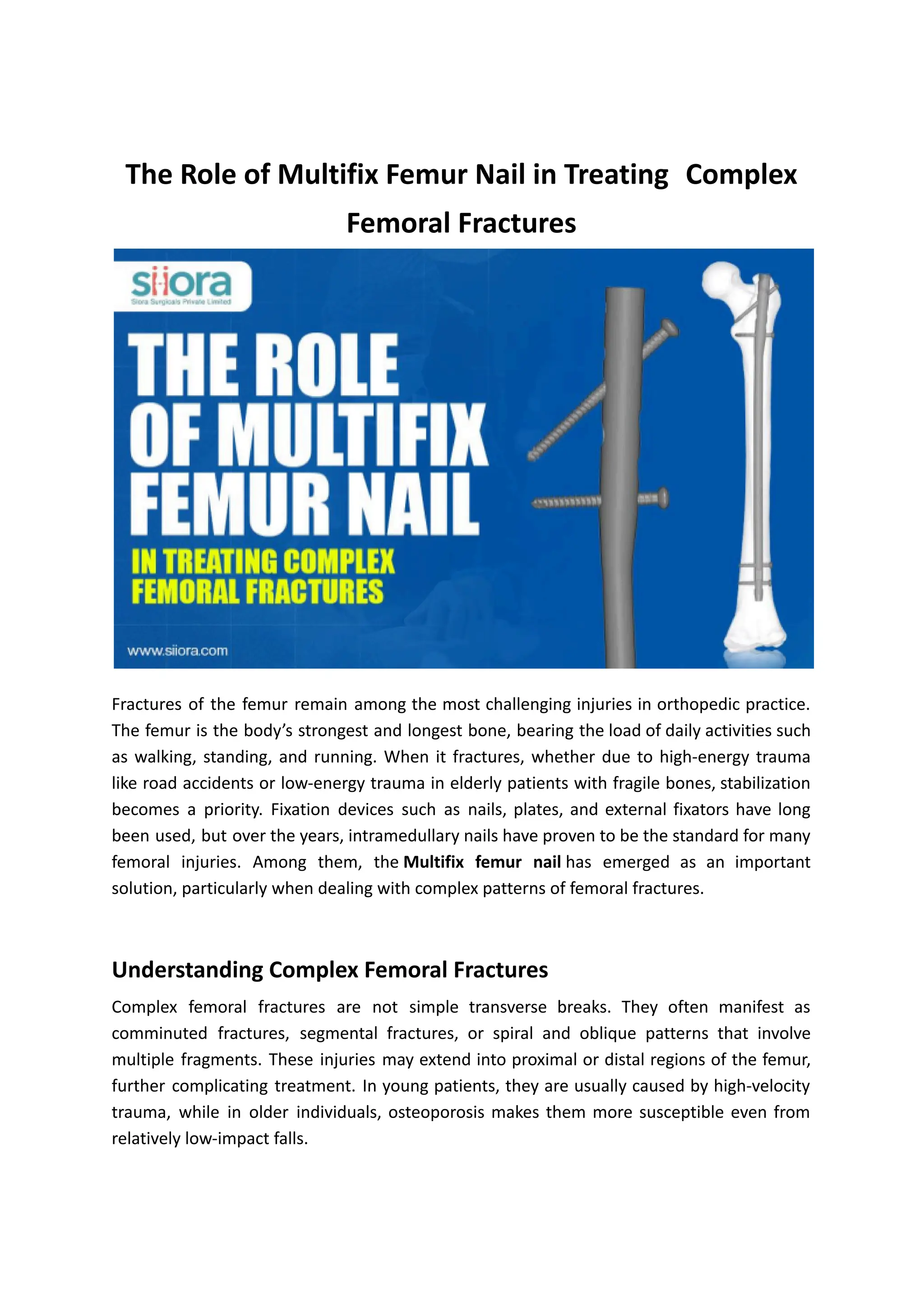 The Role of Multifix Femur Nail in Treating Complex Femoral Fractures | PDF