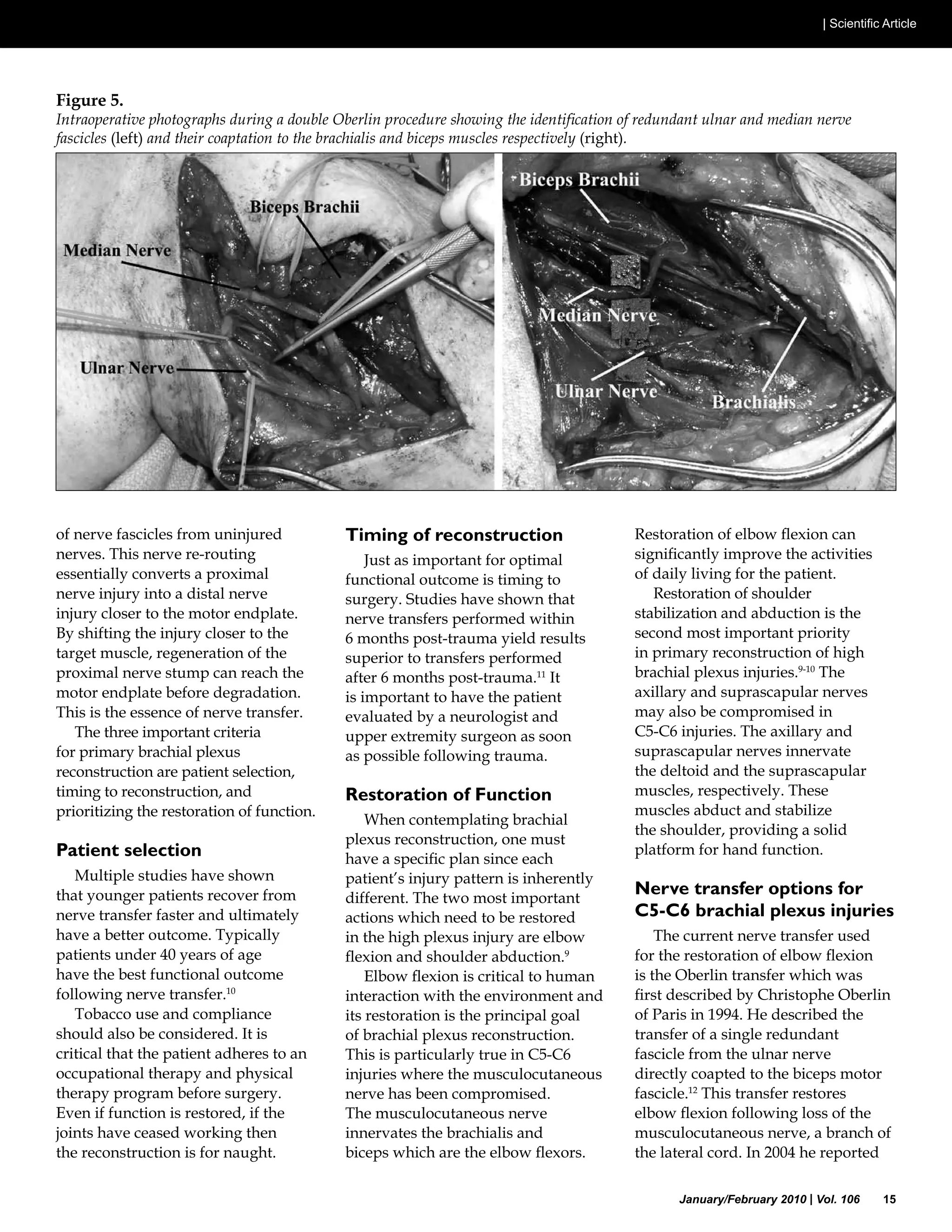 C5 C6 Nerve Transfers for Brachial Plexus Injury | PDF