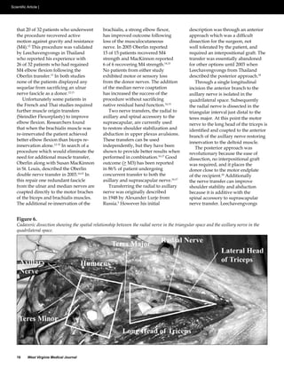 C5 C6 Nerve Transfers for Brachial Plexus Injury | PDF