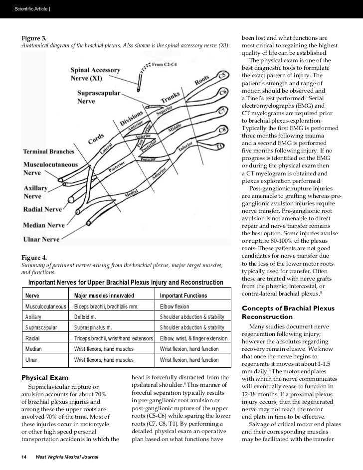 C5 C6 Nerve Transfers for Brachial Plexus Injury