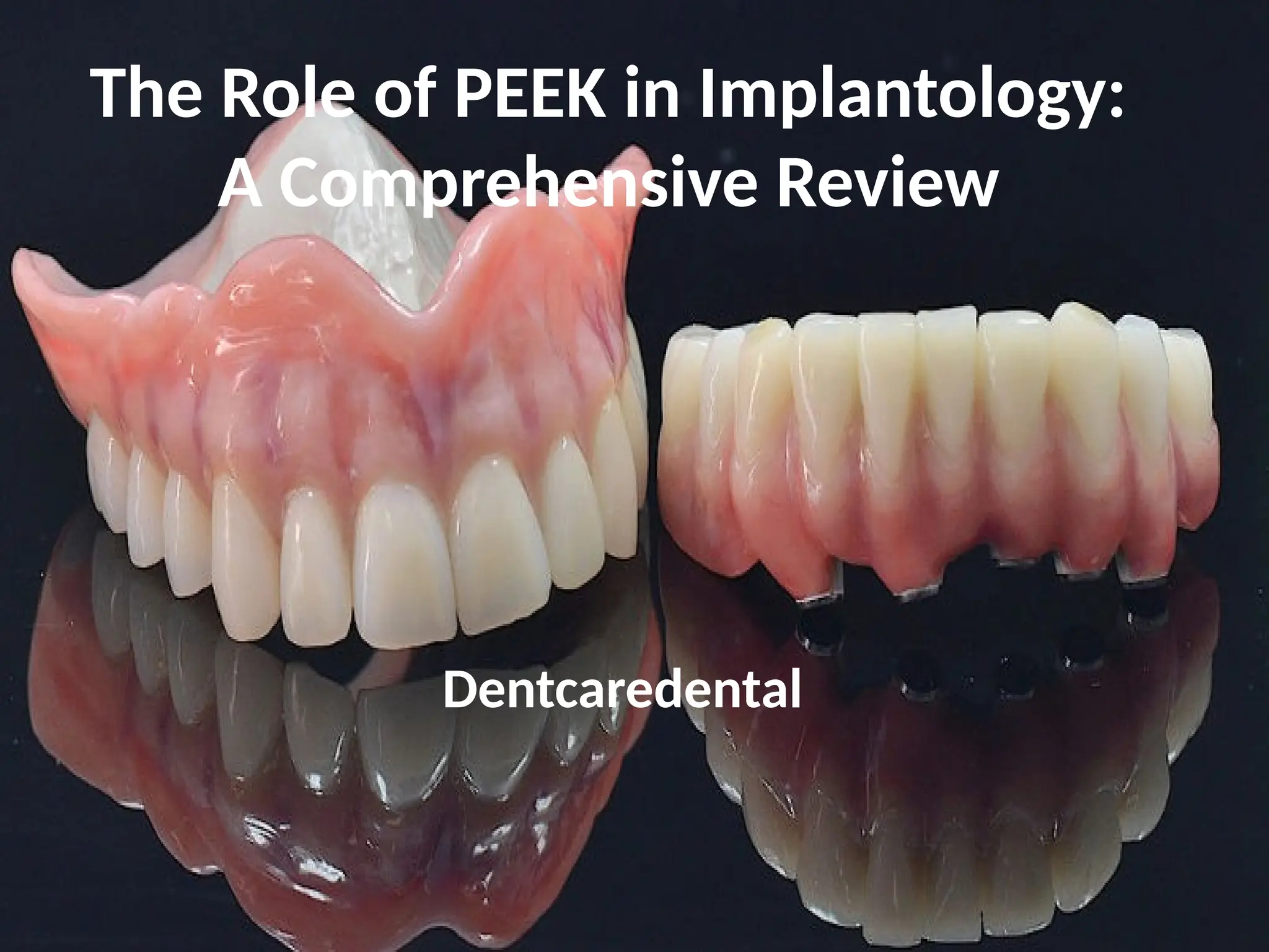 The Role of PEEK in Implantology: A Comprehensive Review.pptx